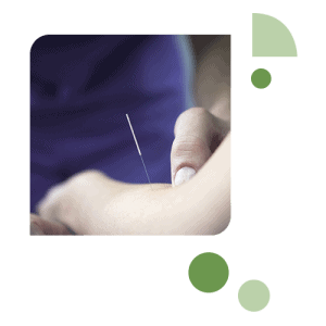 Dry Needling Therapy for Pain and Muscle Dysfunction