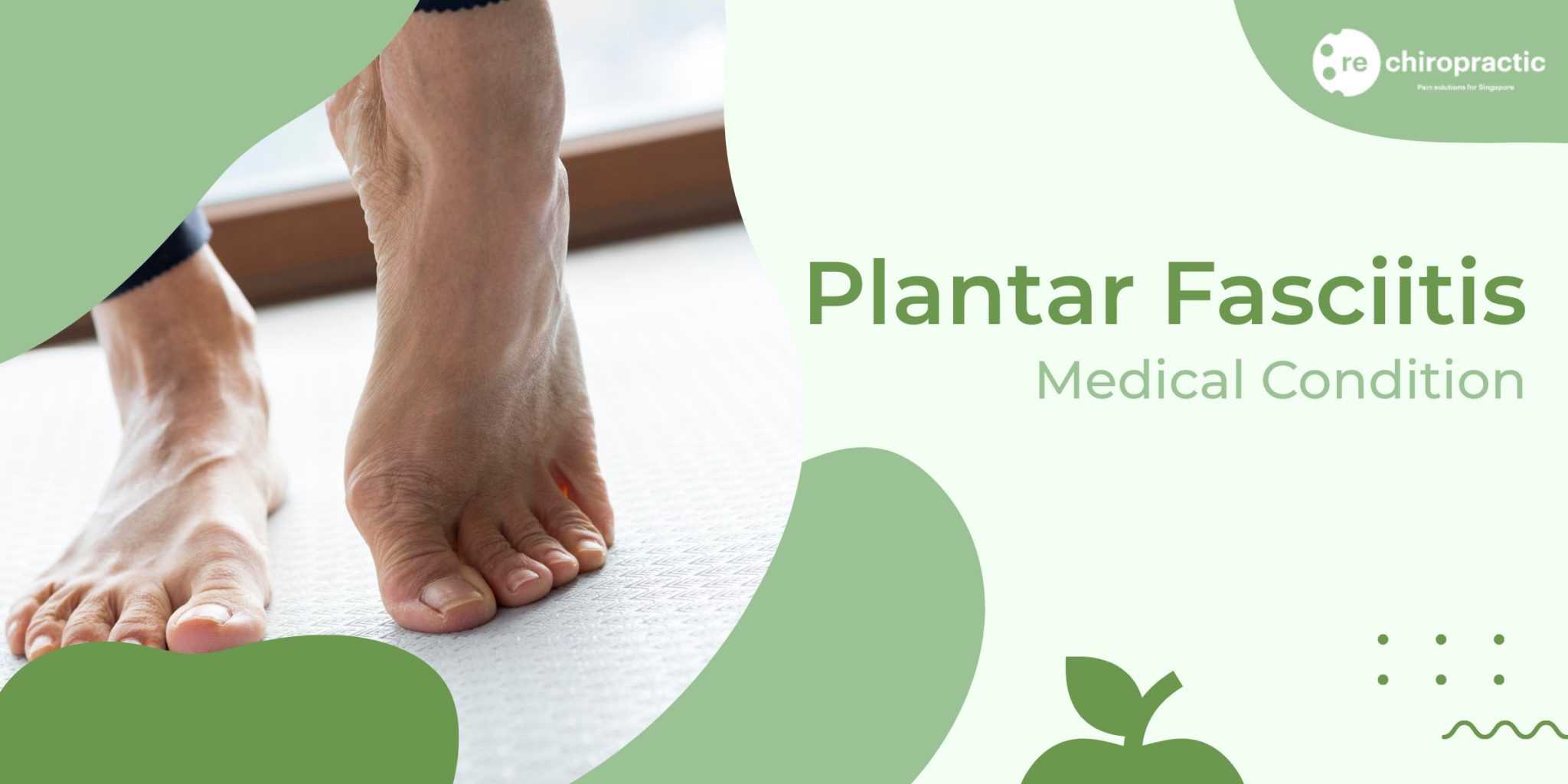 Chiropractic Treatment for Plantar Fasciitis Pain Relief